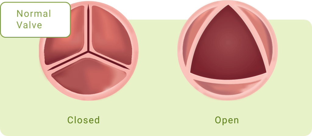Heart Valve Disease Awareness Week 2022 - Global Heart Hub