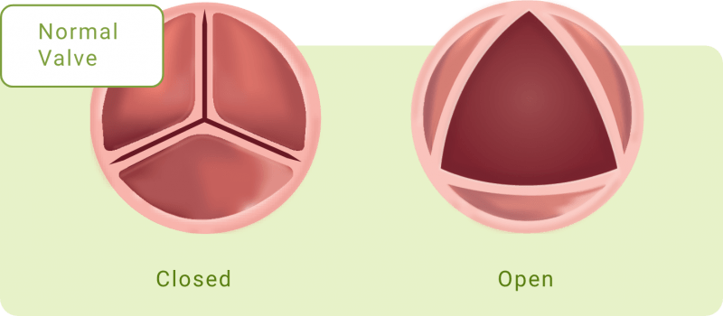 Heart Valve Disease Awareness Week 2022 - Global Heart Hub