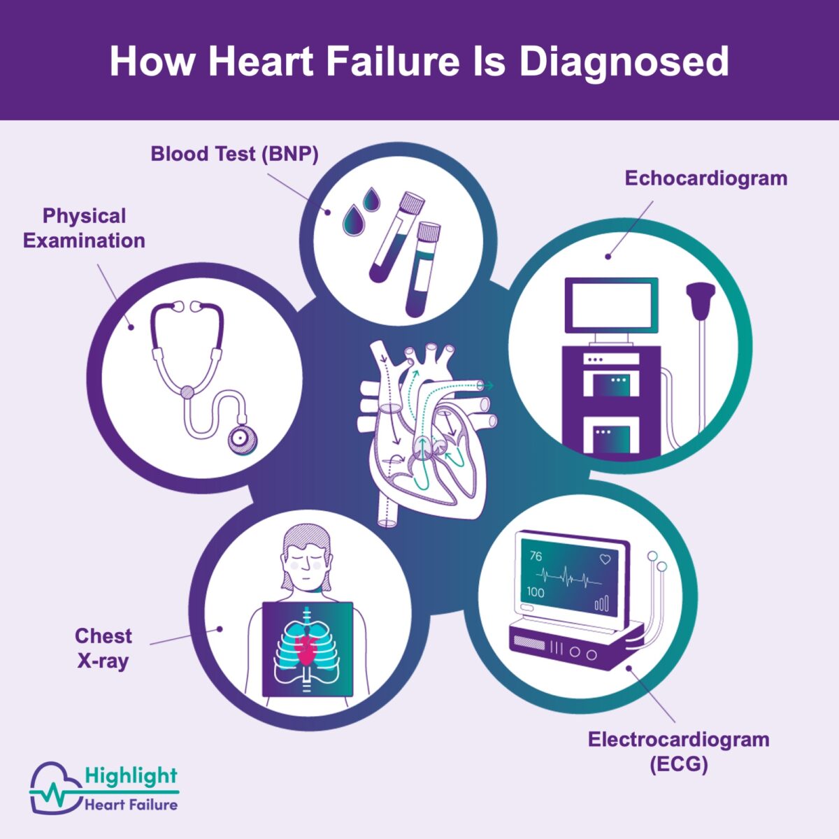 Heart Failure Awareness 2023 - Global Heart Hub